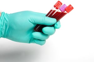 A Quick Phlebotomy Guide